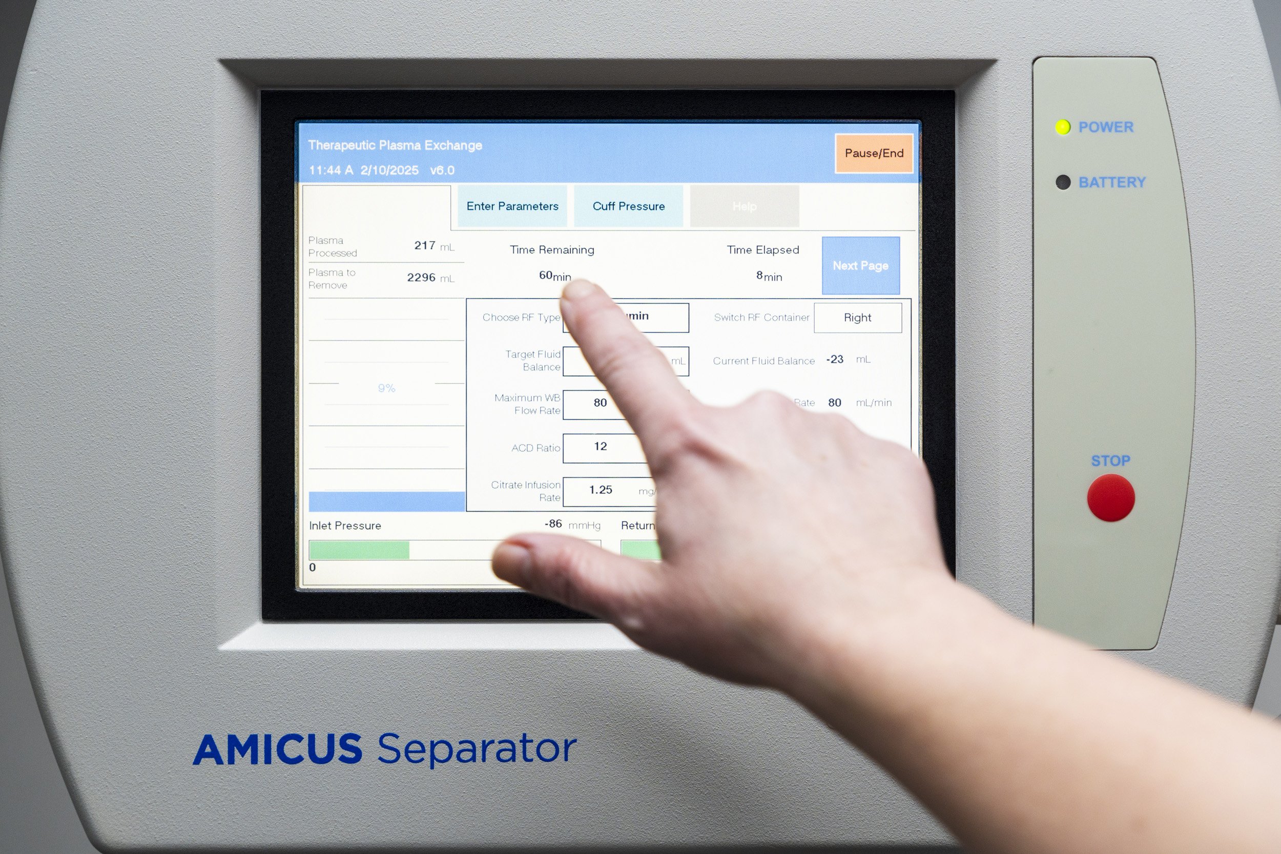 Therapeutic Plasma Exchange for Health Optimization